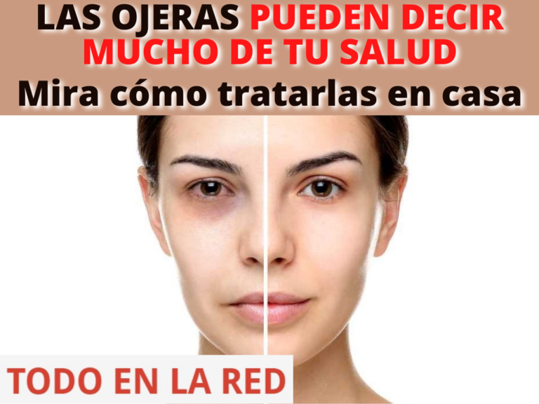 Ojeras: Por qué aparecen y cómo tratarlas – Todo En La Red